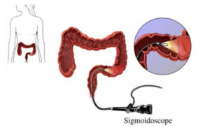 Flexible Sigmoidoscopy | Magnolia Surgery Center